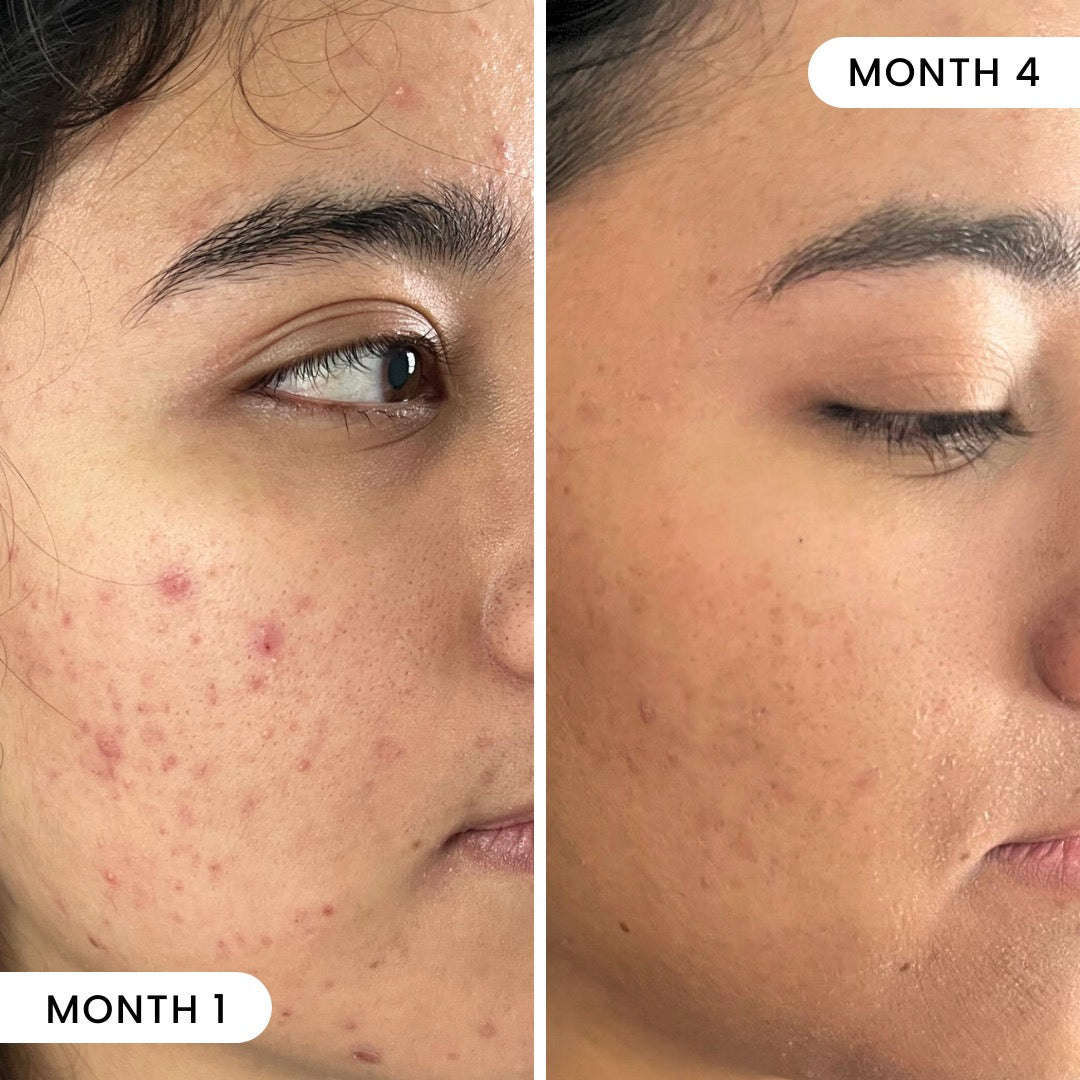 Results – Resolu Method